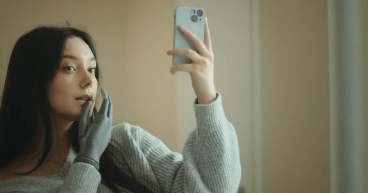 Протез української компанії Esper Bionics потрапив на обкладинку Time ...